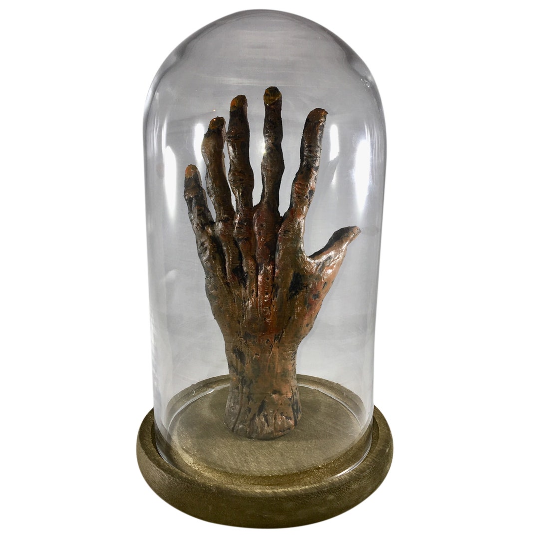 Bizarre! 6 Finger Mummified Hand With Jar Oddity Medical Gaff Mummy - Etsy