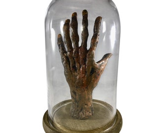 Bizarre 6 Finger Mummified Hand With Jar Oddity Medical Gaff - Etsy