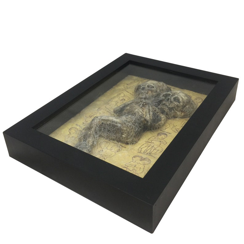 Siamese Twin Fetus Mummified Specimen Conjoined Fetal Frame Two Headed ...