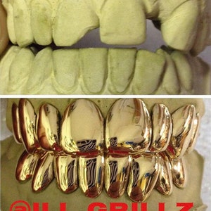 Handmade Custom Grillz in Dental Gold - Etsy