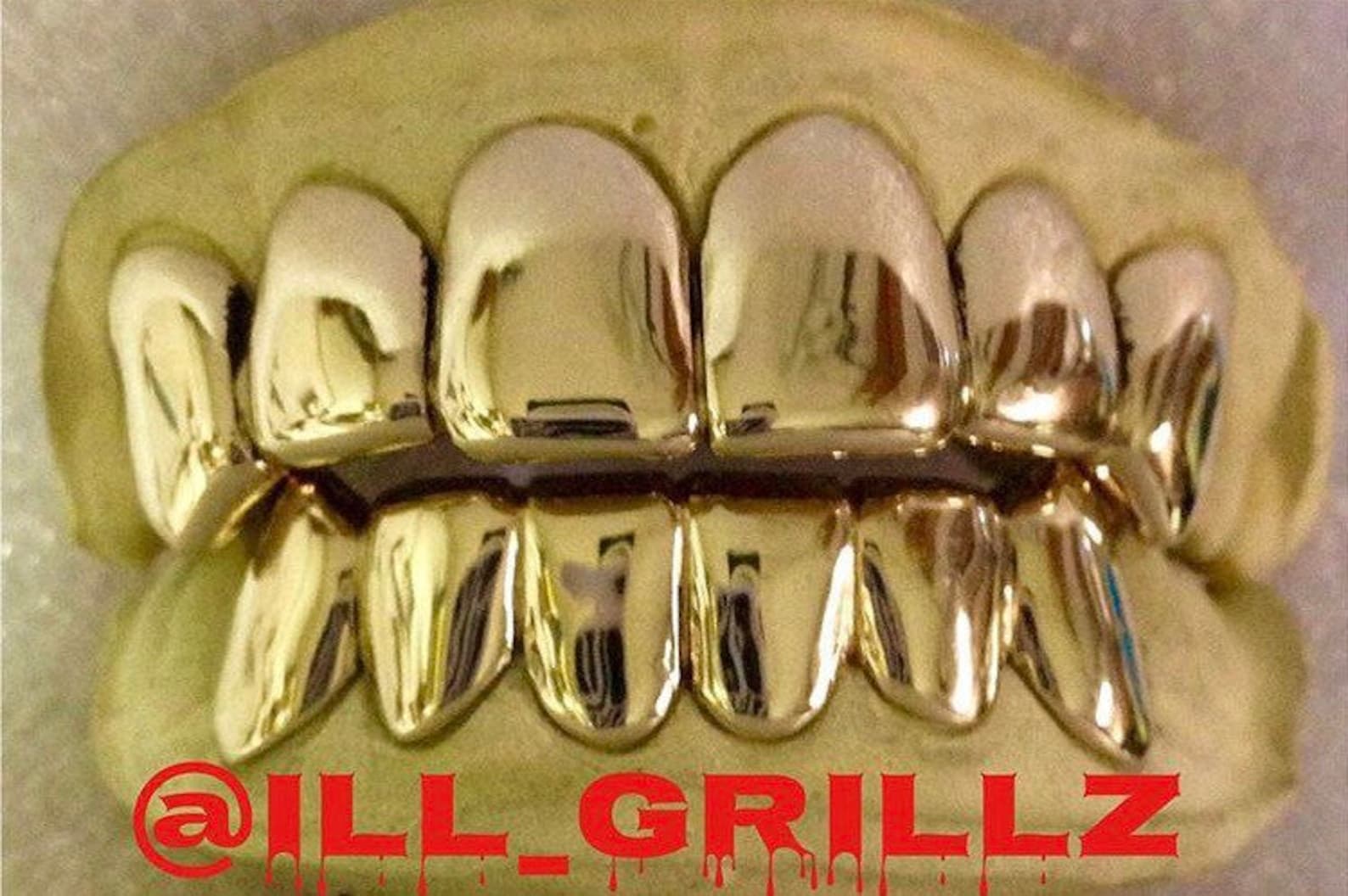 Handmade Custom Grillz in Dental Gold - Etsy