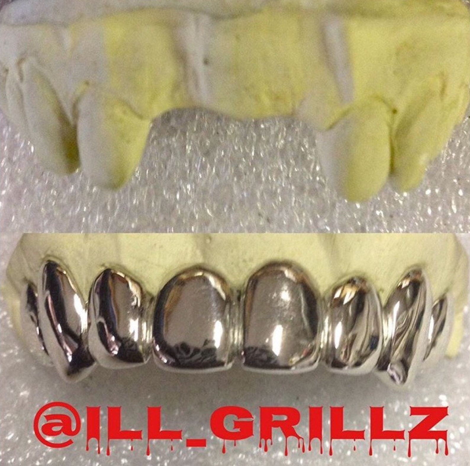 Handmade Custom .925 Sterling Silver Grillz - Etsy