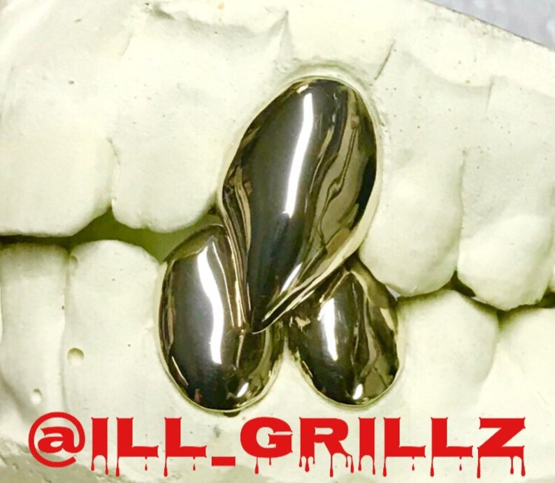 Handmade Custom Dental Gold Top Fangs With Bottom Wolf Style - Etsy