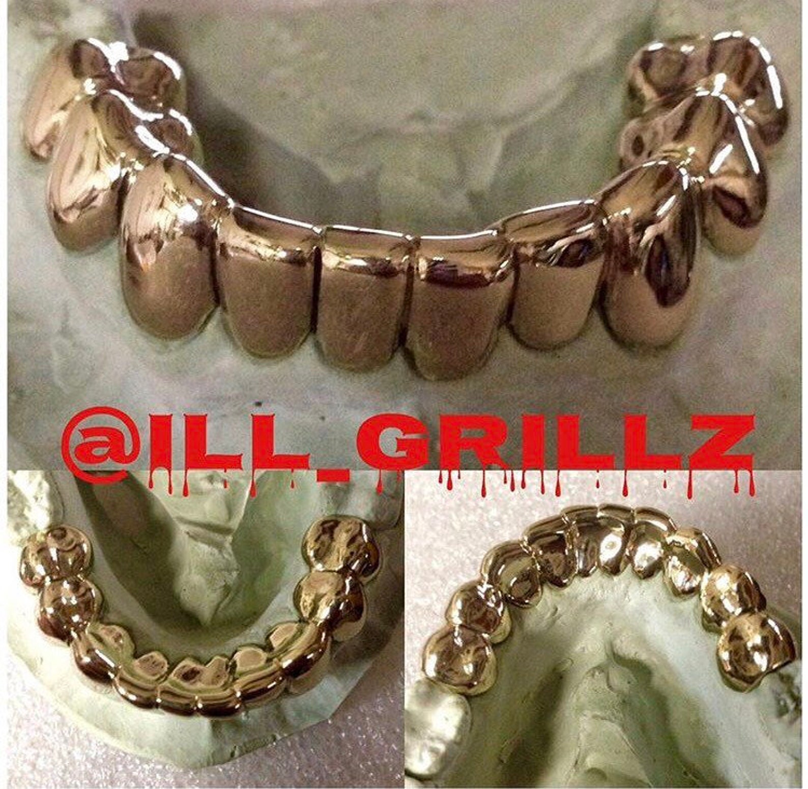 Handmade Custom Grillz in Dental Gold - Etsy