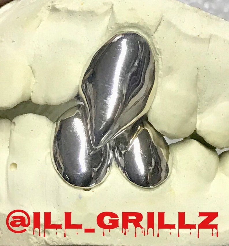 Handmade Custom .925 Sterling Silver Top Fangs With Bottom - Etsy