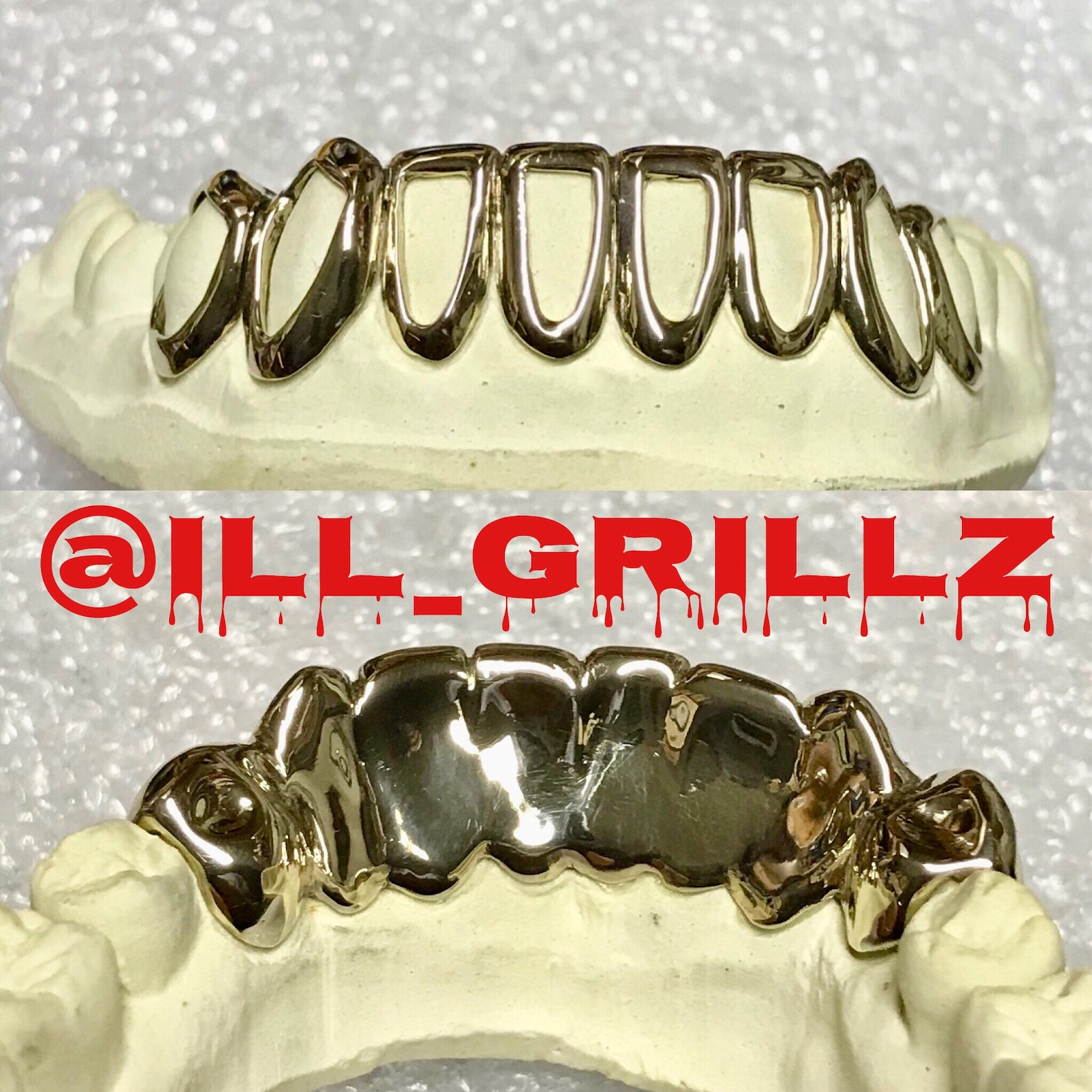 Handmade Custom Permanent Cut Dental Gold Frame Grillz - Etsy