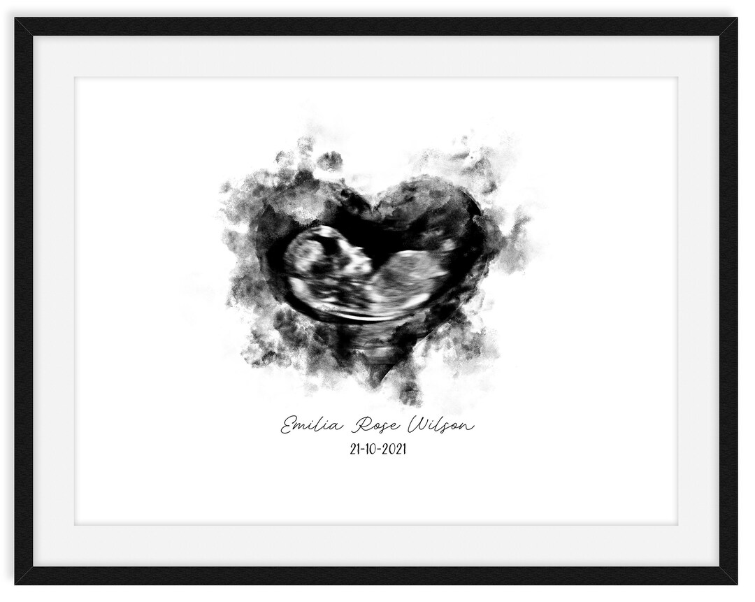 7"x5" Framed Personalised Ultrasound Keepsake Art Print - - Etsy
