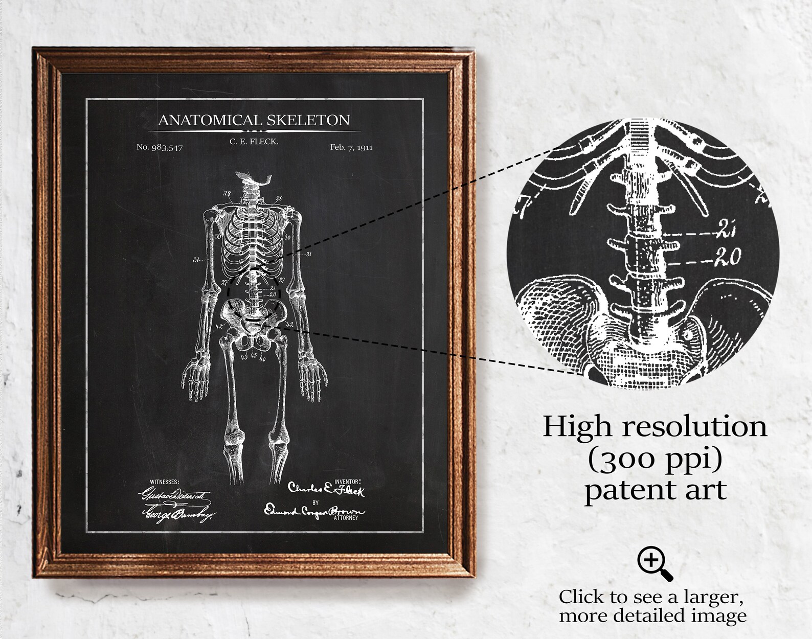 Human Anatomy Patent Prints Set of 3 Vintage Medical Wall | Etsy