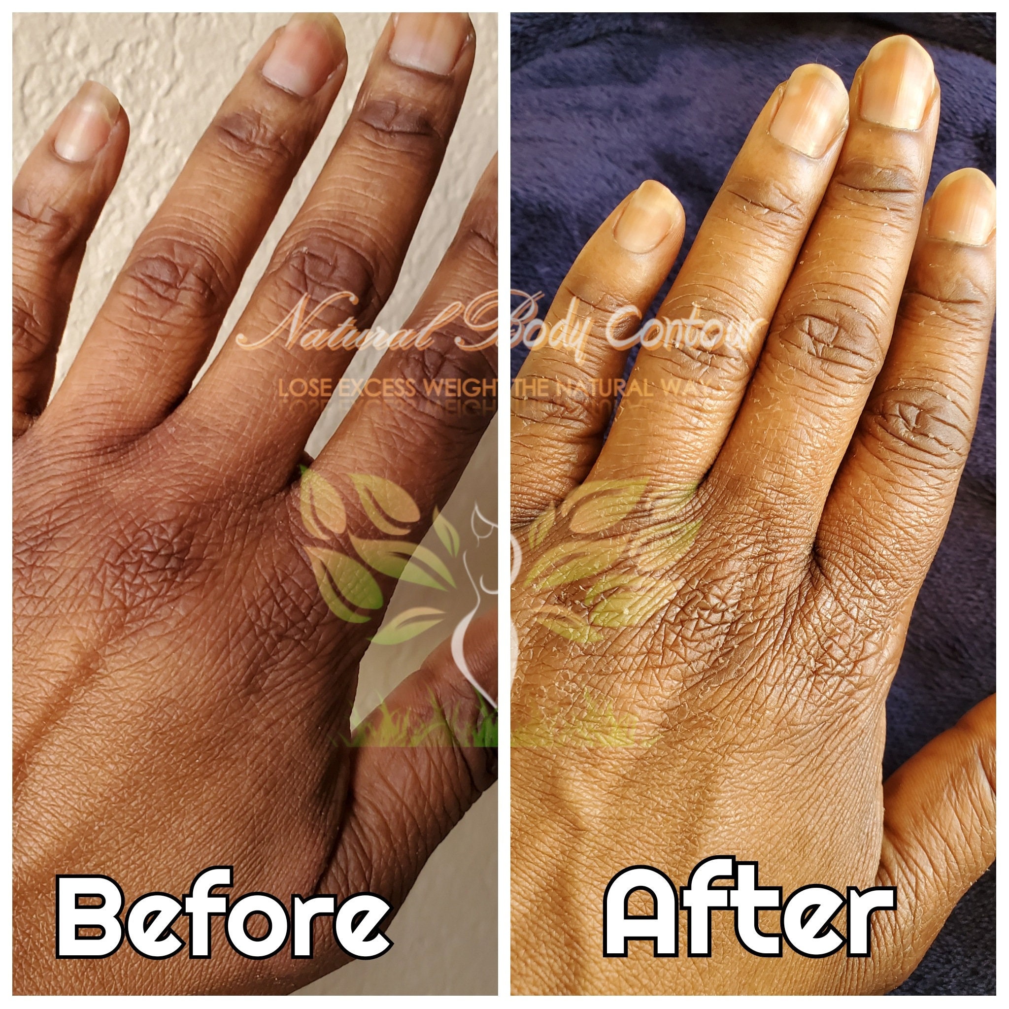 Dark Knuckles System DW Aesthetics, 56% OFF