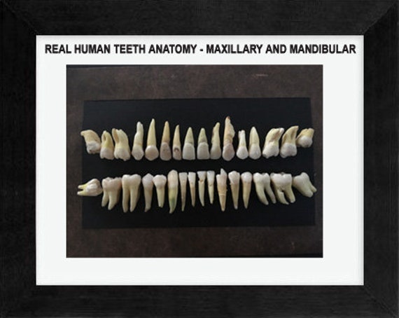 One Complete Set32 OF Real Human Teeth-framed | Etsy
