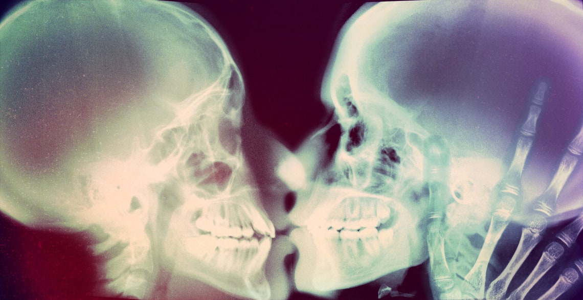 Authentic Real Kissing Xrays Lot Of 5 Etsy