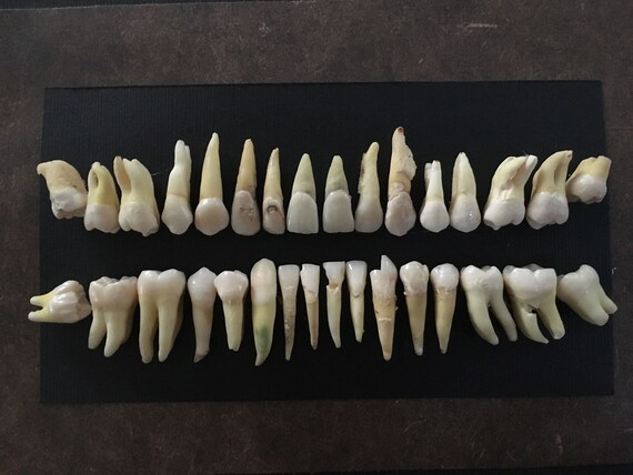 Real Human Teeth