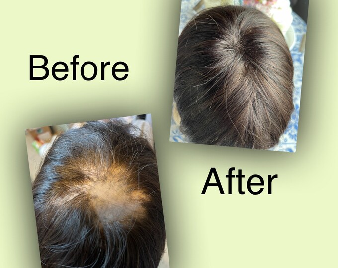 Two Hour Wig Ventilating Plus Knot Bleach Service and Repair Add Hair ...