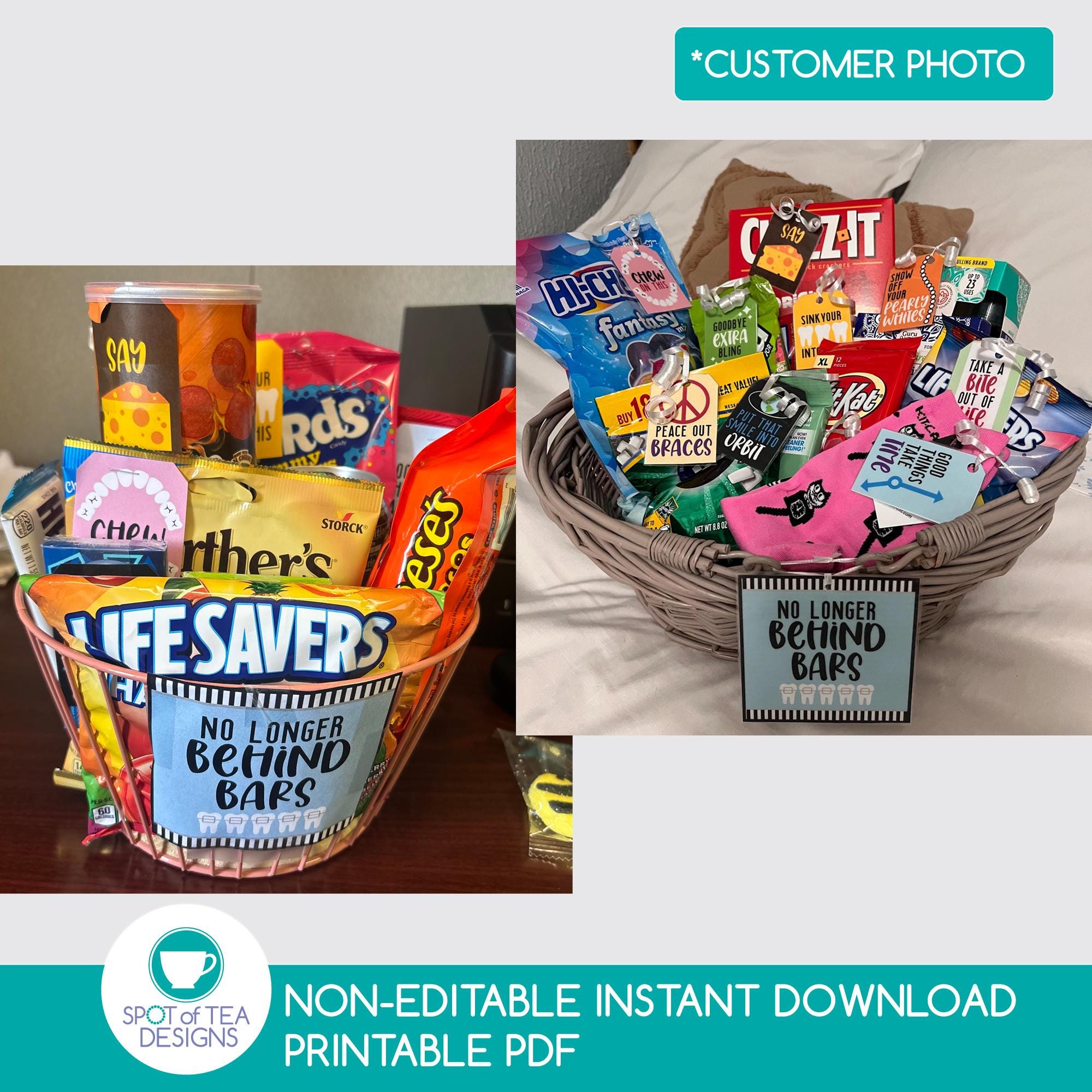 Braces off Gift Basket Printable Kit: Tween Braces Removal Care Package ...