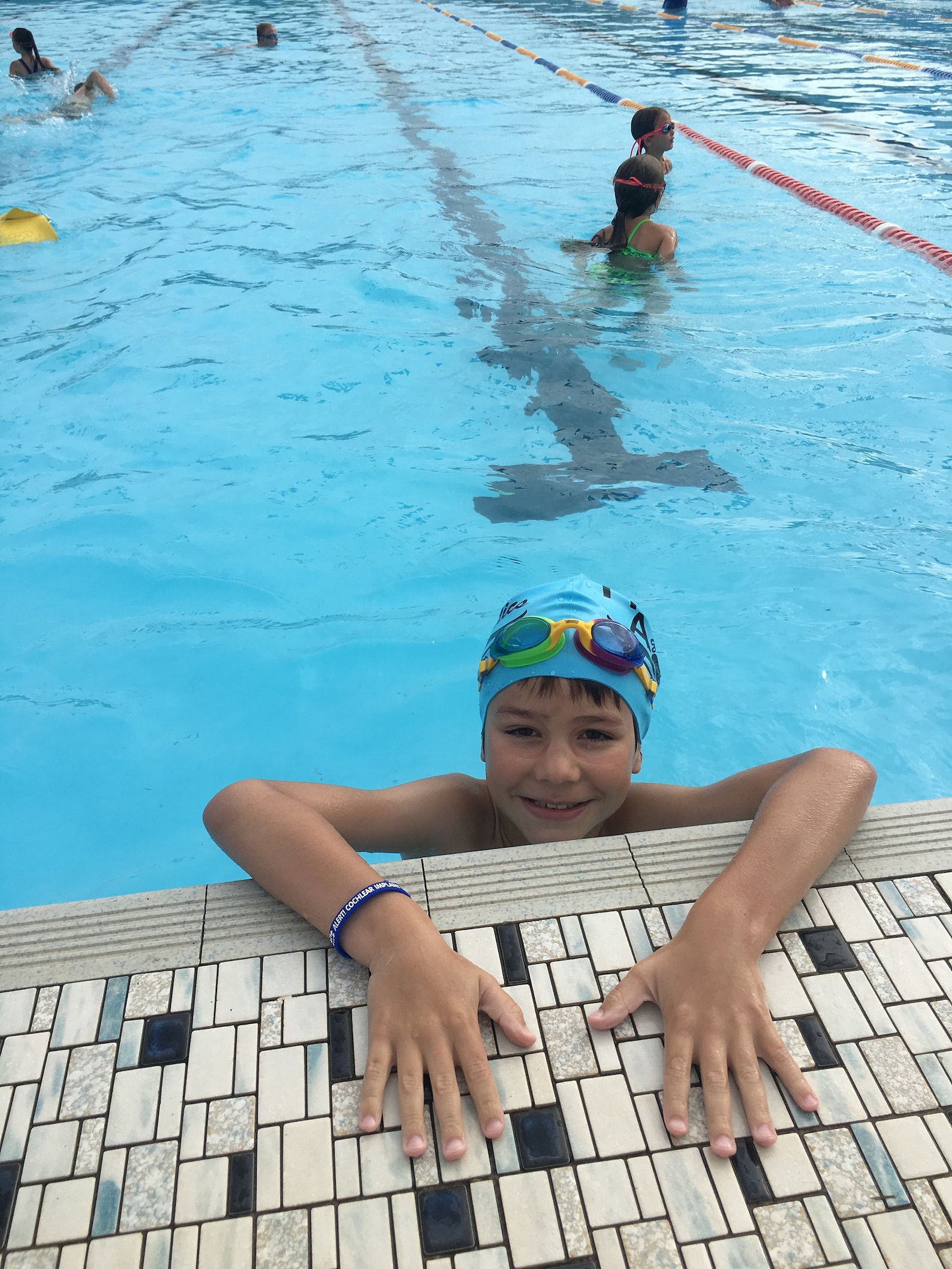 Cochlear Implant Medical Alert Bands - Etsy