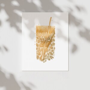 Skin Anatomy Art Dermatology Foil Print Medical Student Gift Skin Care ...