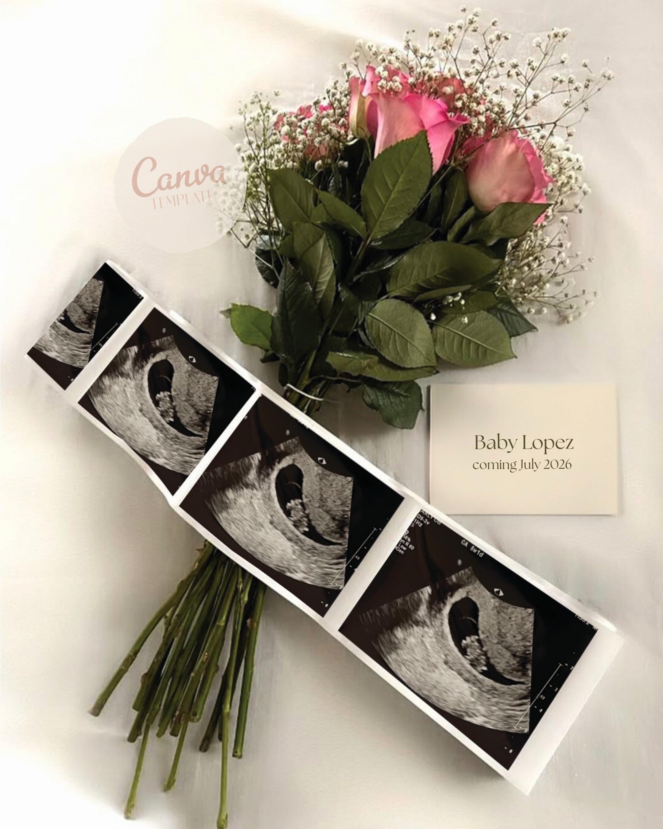 Floral Pregnancy Announcement: Digital Canva Template (it's a Girl!) - Etsy