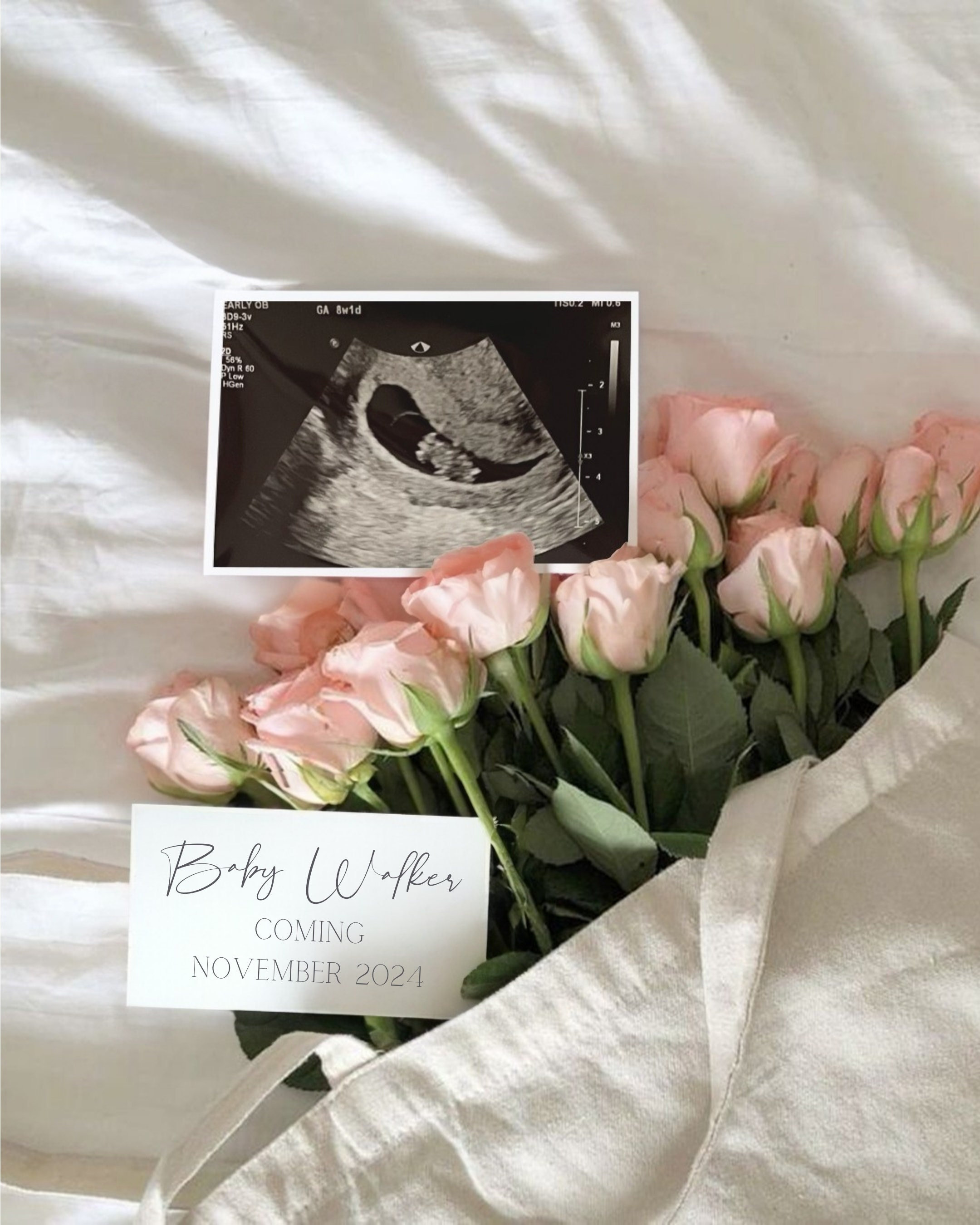 EDITABLE Simple Spring Pregnancy Announcement | Flower Pregnancy ...