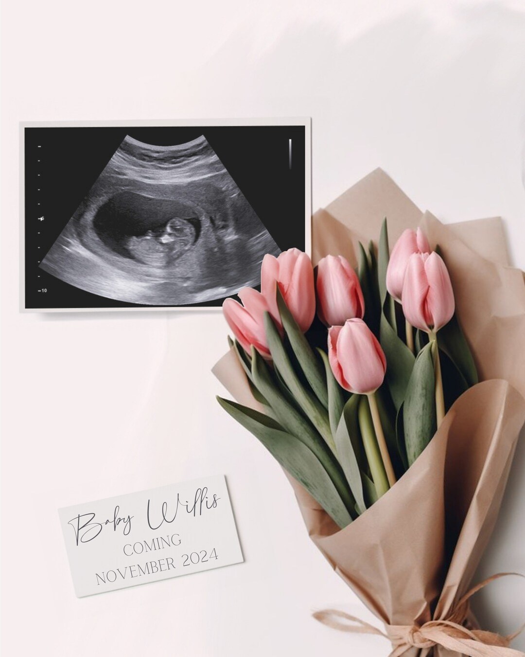 EDITABLE Simple Girl Spring Pregnancy Announcement | Easter Pregnancy ...