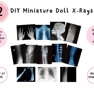 12 DIY Miniature Doll's X-rays - Instant Download, Print at Home, Fits ...