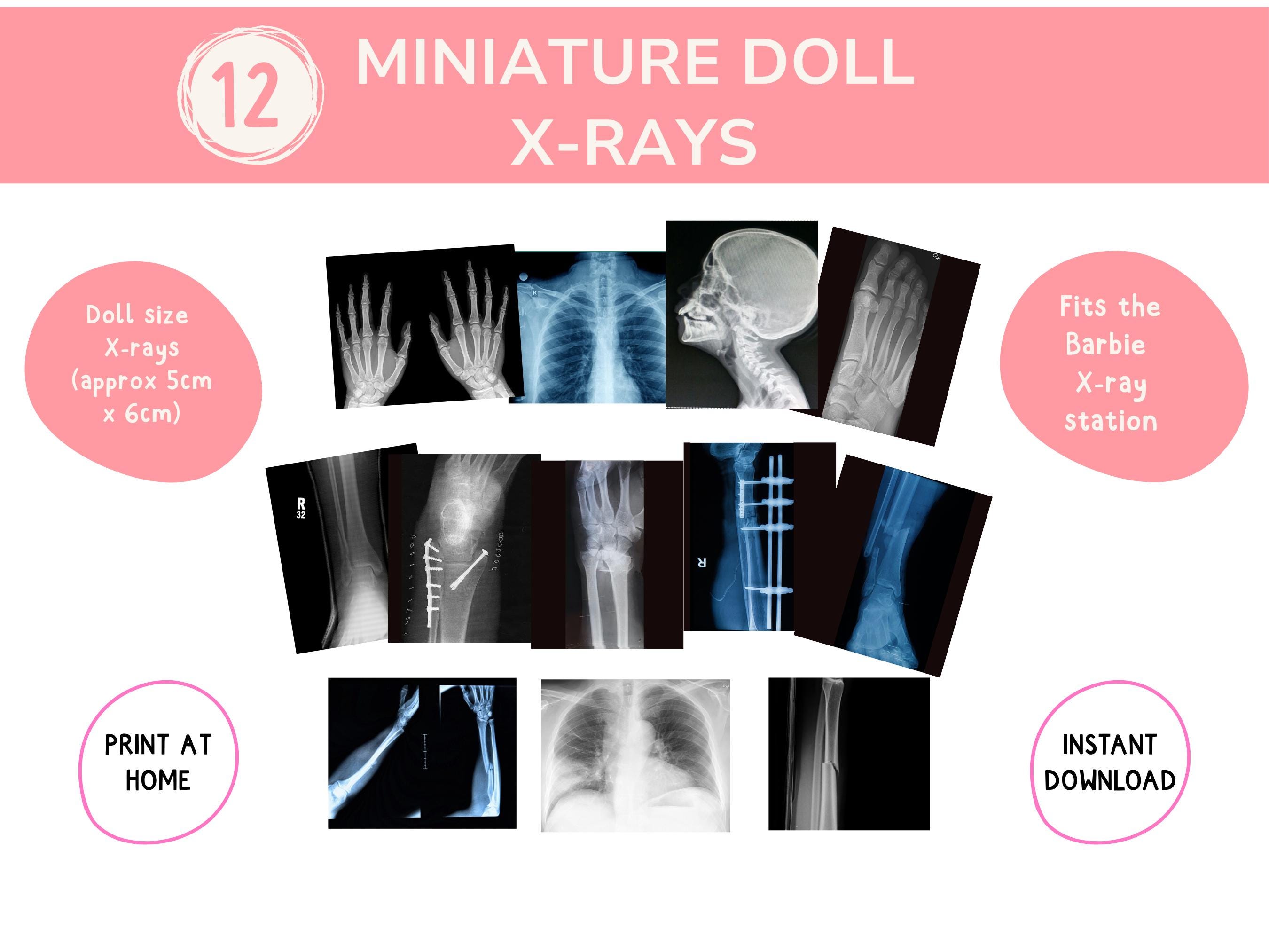 12 DIY Miniature Doll's X-rays - Instant Download, Print at Home, Fits ...