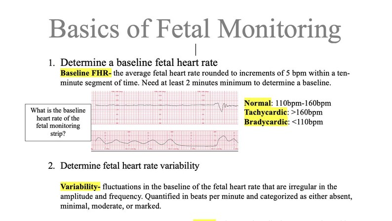 Labor and Delivery Nursing: Basics of Fetal Monitoring Reference Guide ...