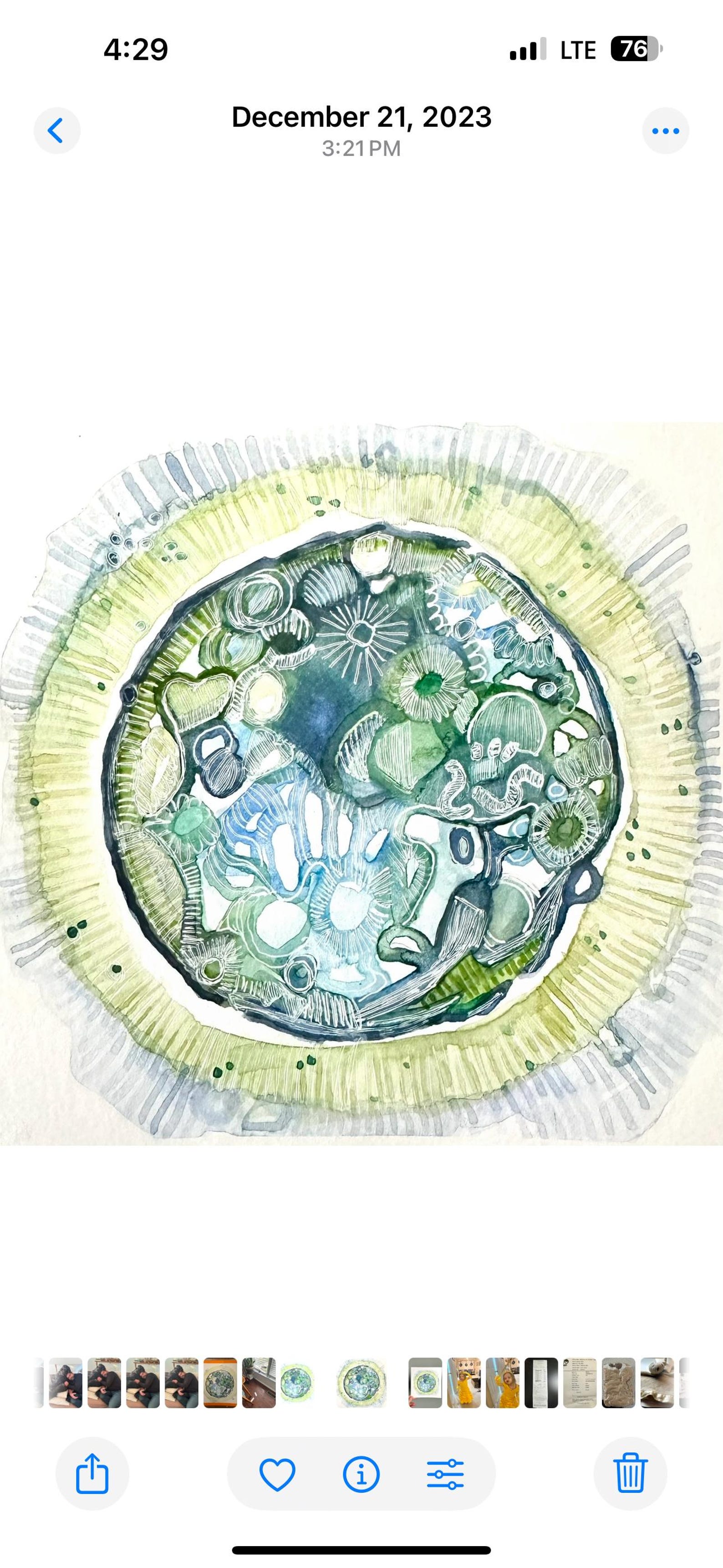 EMBRYO ART: Custom Blastocyst IVF Gift; Personalized Pregnancy ...