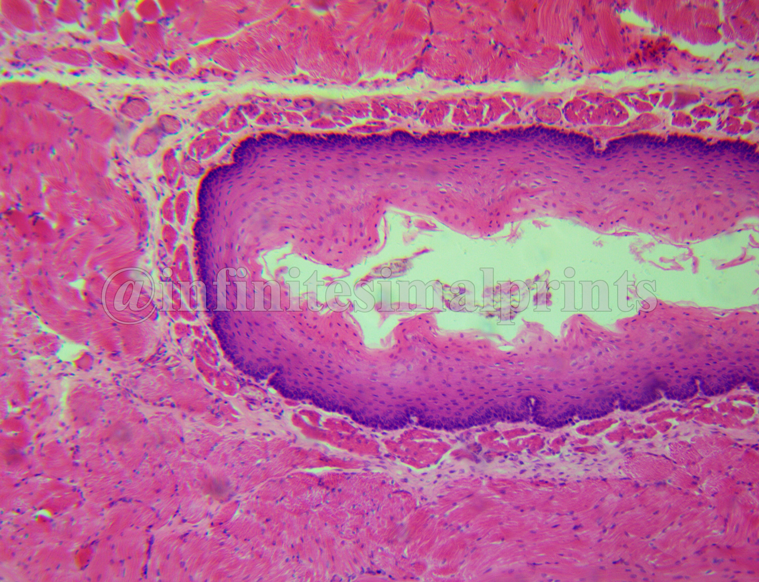 Esophagus Microscope Slide