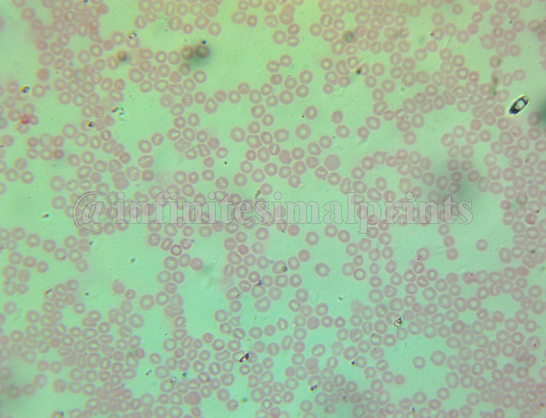 Human Blood Smear Print, 12x18, Human Art, Microscope Art, Microscope ...