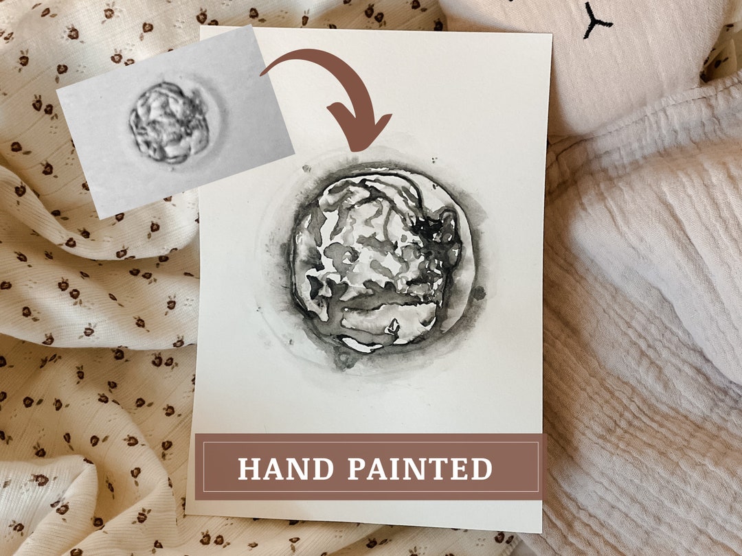 Heirloom IVF Embryo Ultrasound Watercolor Painting | Baby Embryo ...