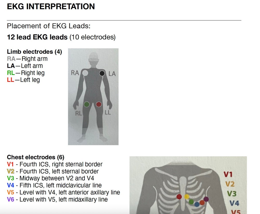 EKG Interpretation Guide / Heart Rhythms / EKG Guide - Etsy