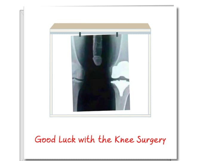 Printable Funny Get Well Soon Knee Surgery Card, Knee Surgery Pun Card ...