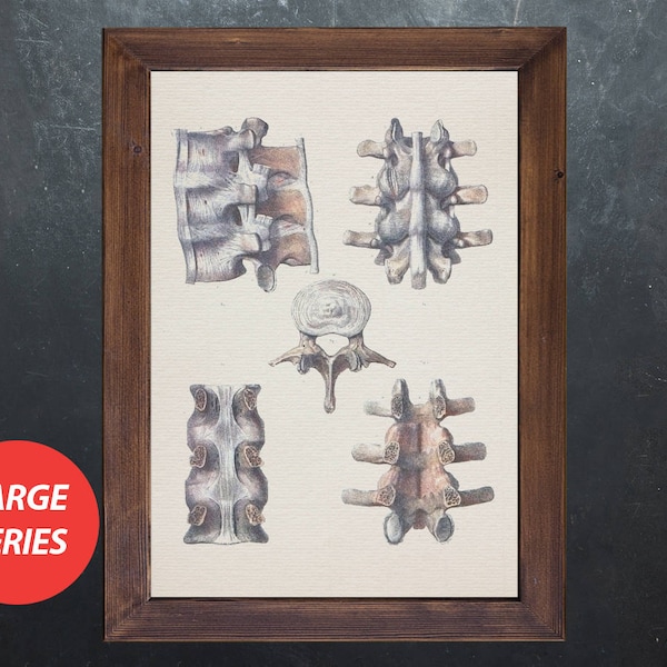 Radiology Art Poster - Etsy