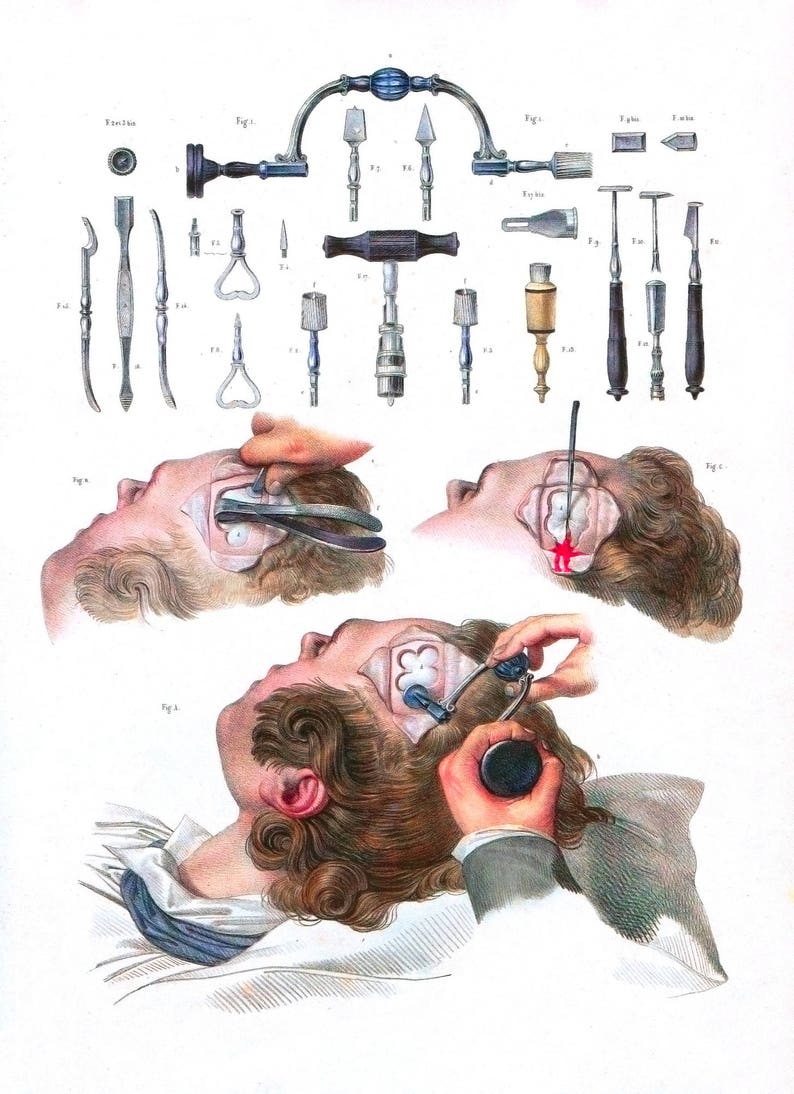 Anatomy Art SKULL BRAIN TREPANNING Psychology Medical Student Gift ...