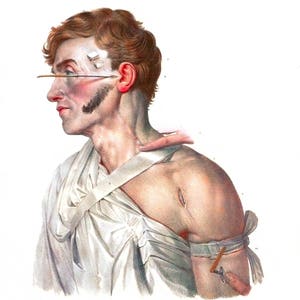 Anatomy Art SURGERY METHOD INCISION Medical Medical Student - Etsy