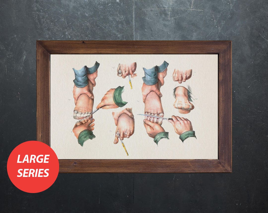 Anatomy Art TOES AMPUTATION Amputate Surgery Medical Student Gift ...