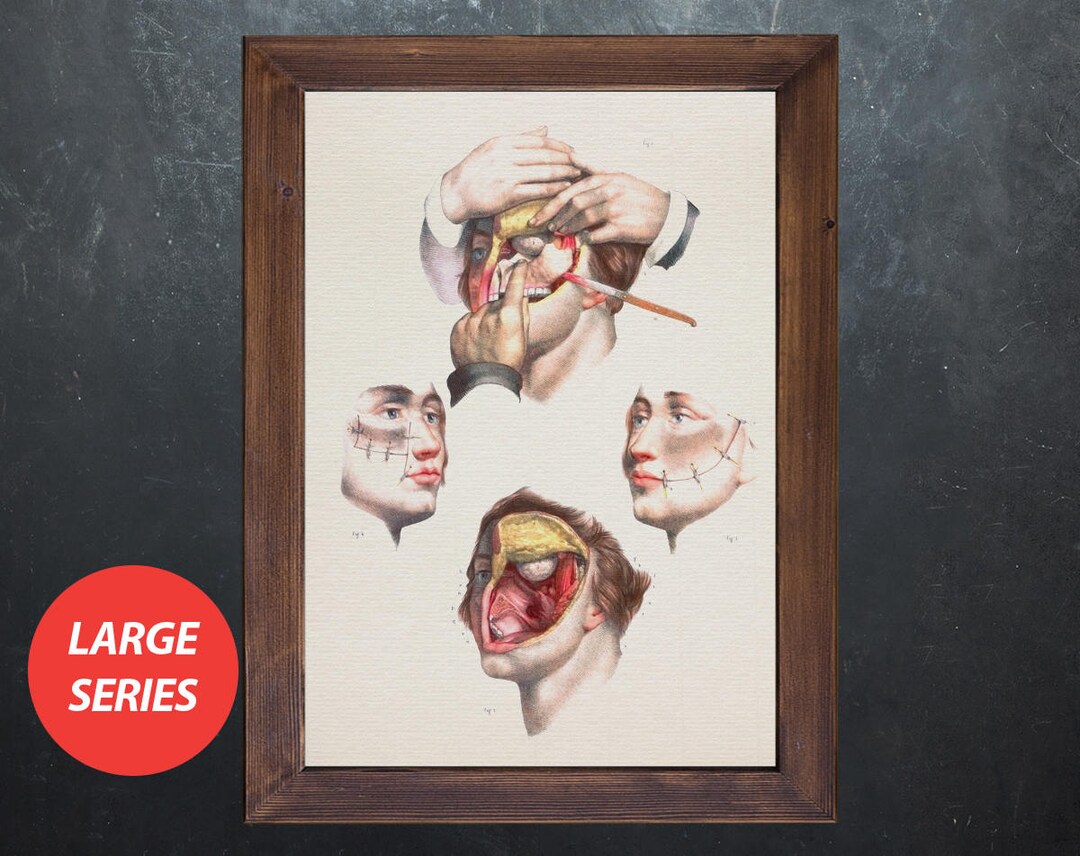 Anatomy Art AMPUTATE TOP JAW Dentist Medical Student Gift, Anatomical ...