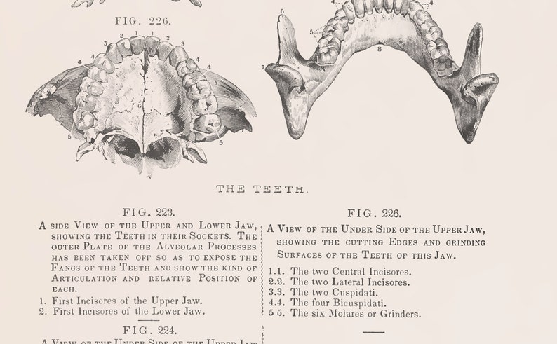 TEETH SOCKETS et JAW anatomie art print pour le dentiste et le - Etsy ...