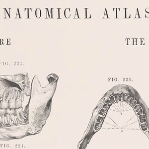 TEETH SOCKETS et JAW anatomie art print pour le dentiste et le - Etsy ...