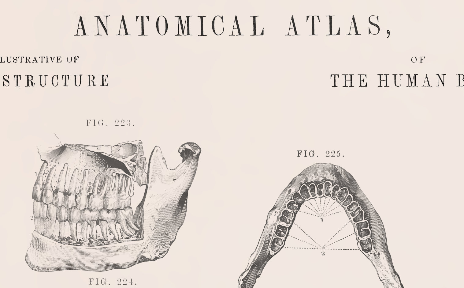 TEETH SOCKETS et JAW anatomie art print pour le dentiste et le - Etsy ...