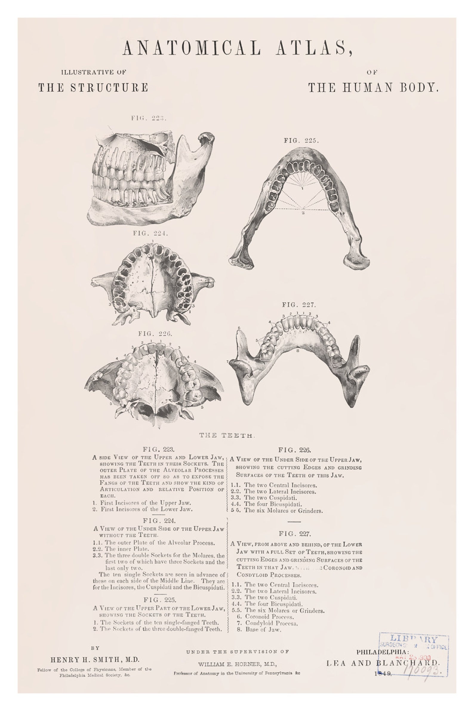 TEETH SOCKETS et JAW anatomie art print pour le dentiste et le - Etsy ...