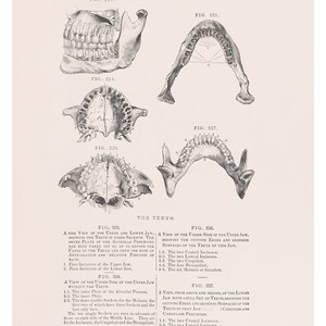 TEETH SOCKETS et JAW anatomie art print pour le dentiste et le - Etsy ...
