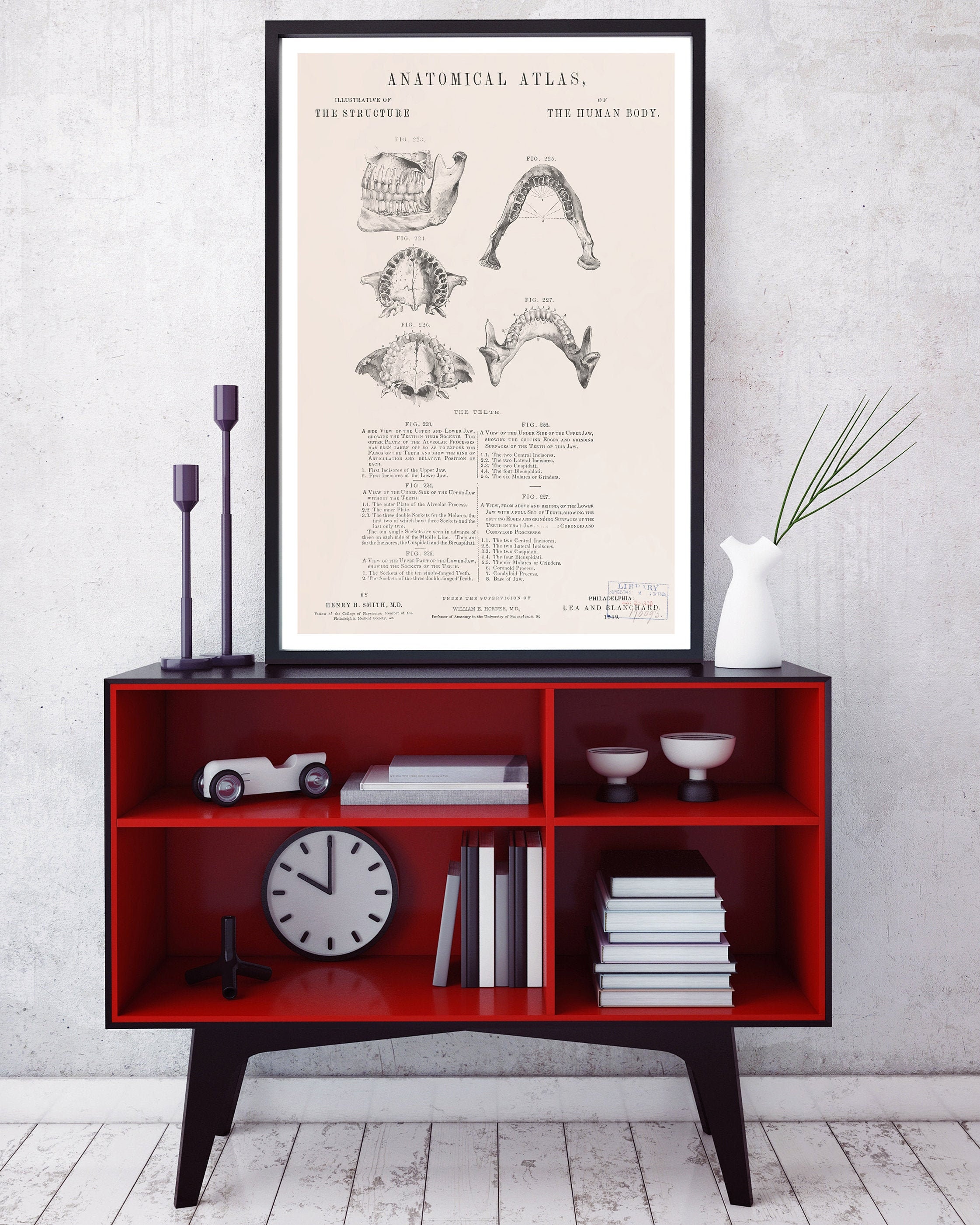 TEETH SOCKETS et JAW anatomie art print pour le dentiste et le - Etsy ...