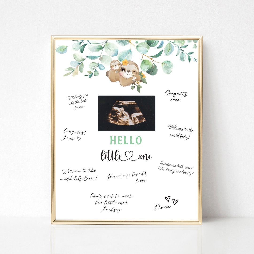 Printable Sonogram Ultrasound Guestbook, Greenery Gender Reveal Party ...