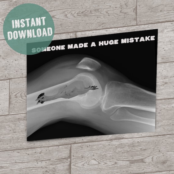 Funny Knee Replacement Surgery Card surgical Get Well - Etsy