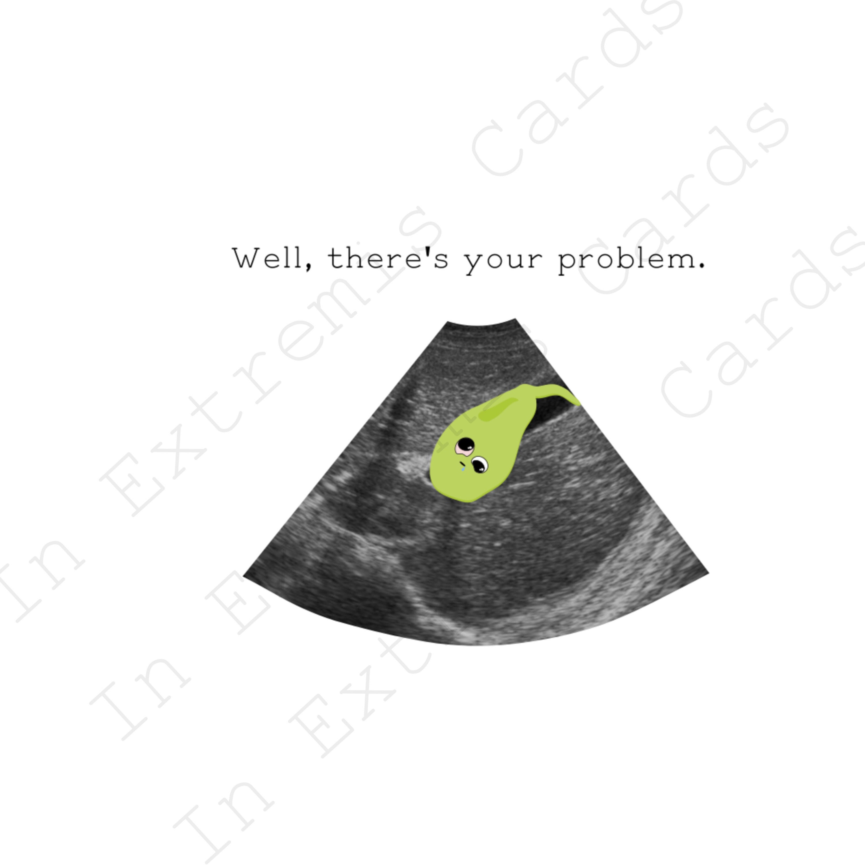 Gallbladder Surgery Card (ultrasound Cholecystectomy Get Well Greeting ...