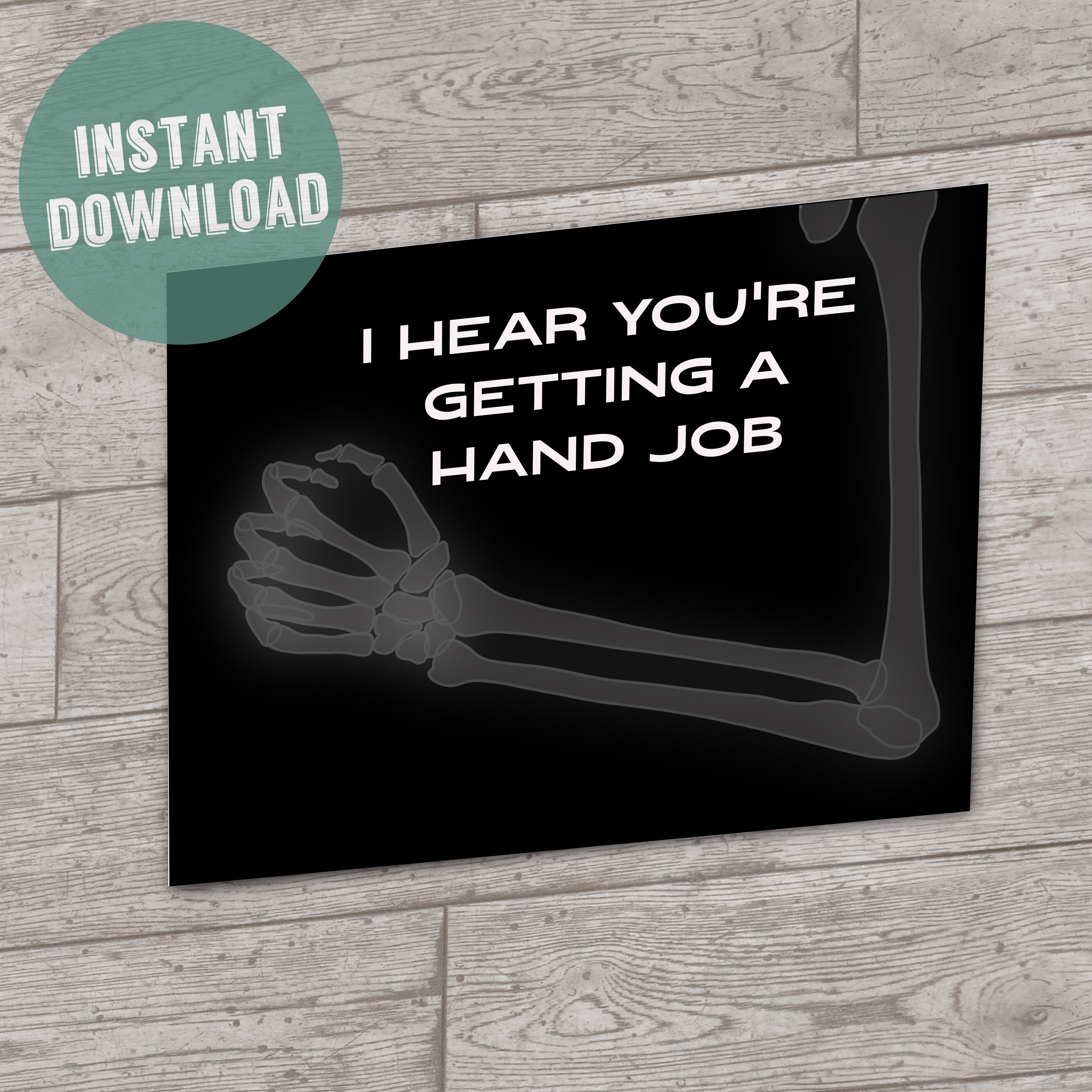 Funny Hand Surgery Card (carpal Tunnel Surgery, Trigger Finger Surgery ...