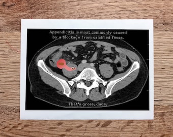 Funny Appendectomy Get Well Card (appendix Removal Surgery ...