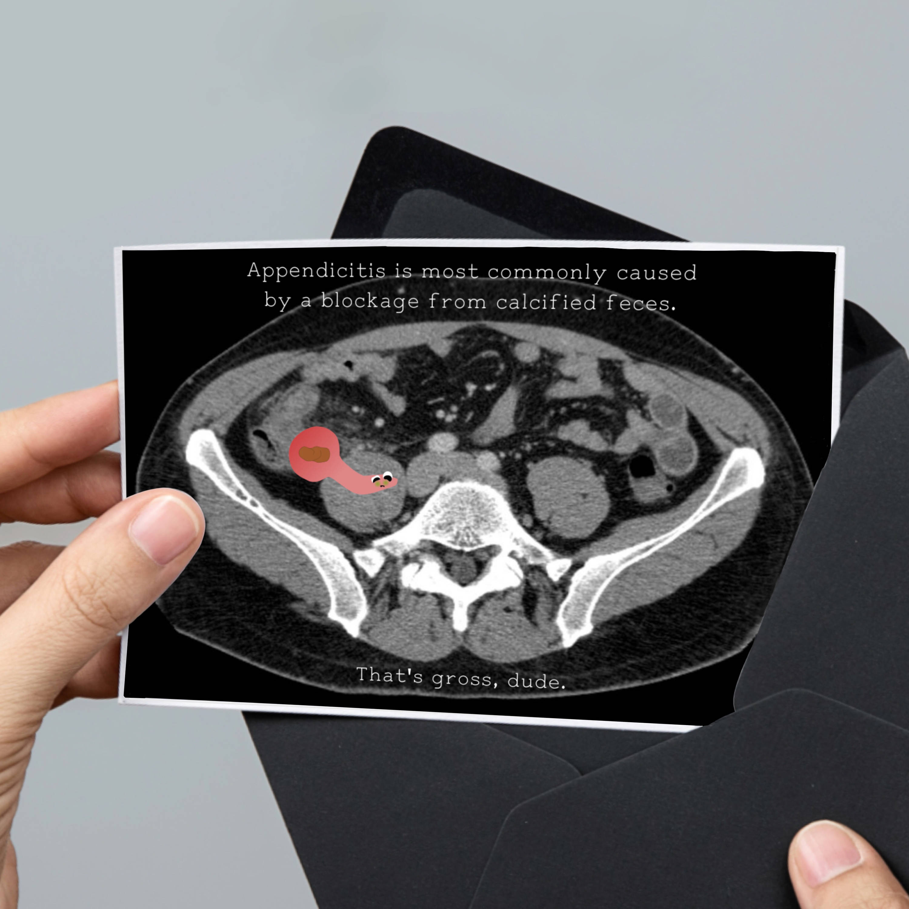 Funny Appendectomy Get Well Card (appendix Surgery Removal ...