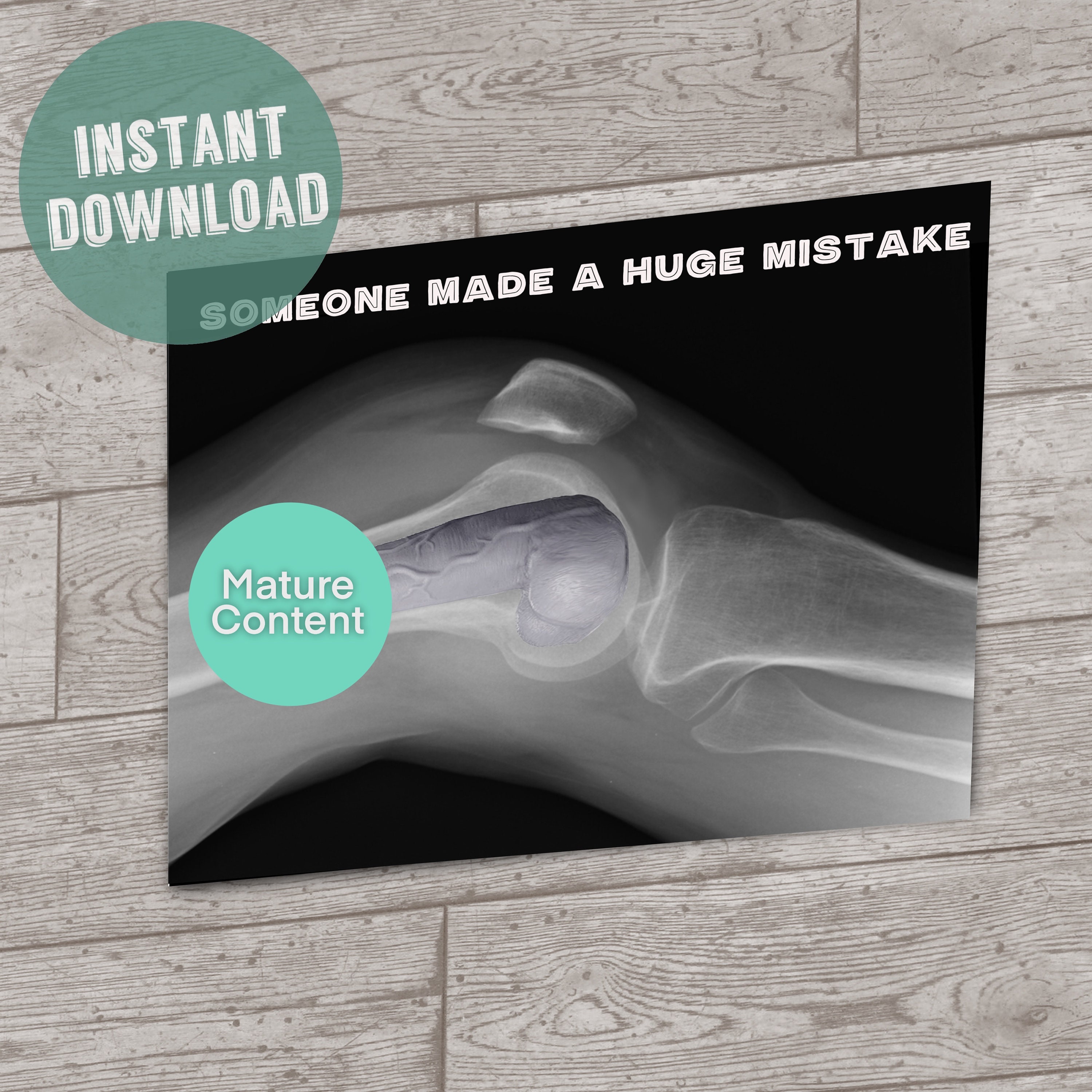 Funny Knee Replacement Card (surgical Get Well Hospital Greeting, Knee ...